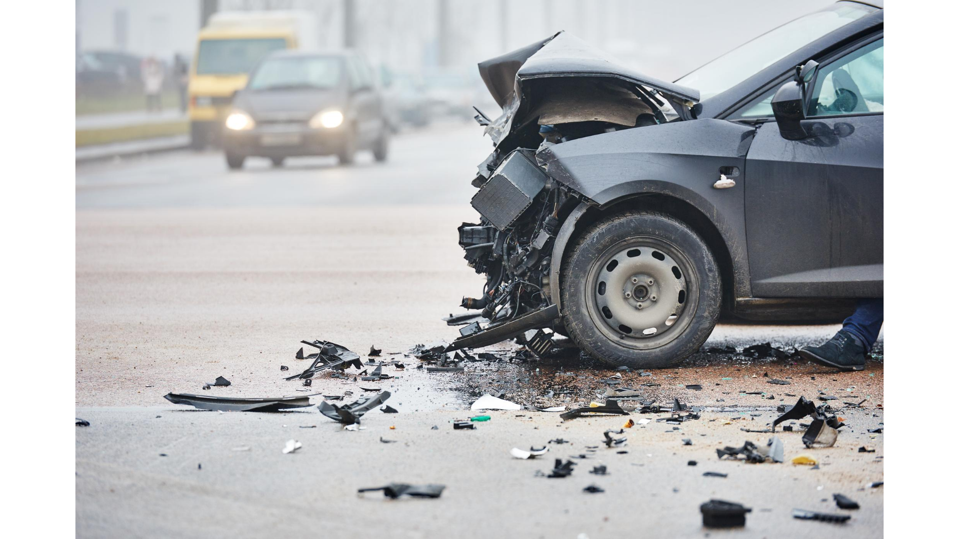 How Chiropractors Can Help After A Car Accident: Whiplash Management